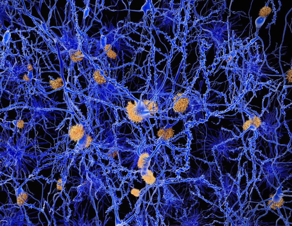 Brainwave Entrainment - Gamma - Reversal Solutions, Inc